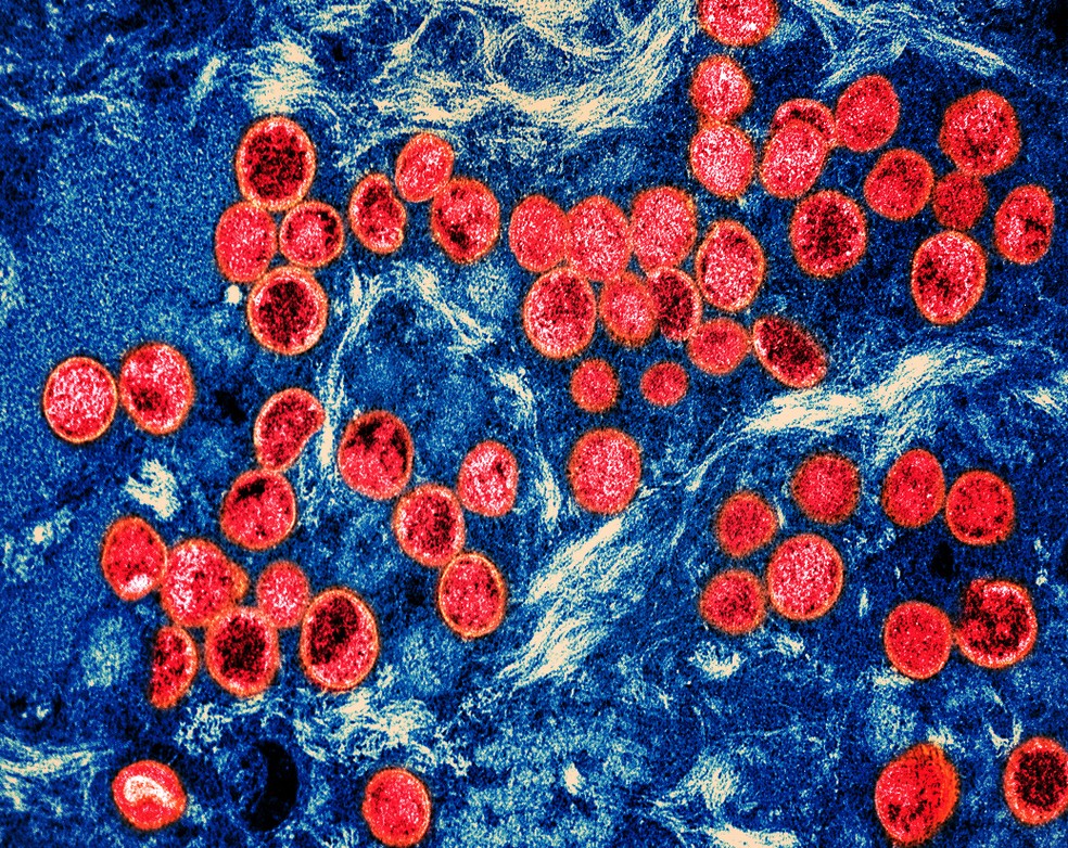 Monkeypox: macacos não são vetores comuns da doença. Saiba como se proteger
